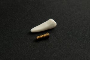 ⊛ ¿Qué es un perno dental y para qué se utiliza?